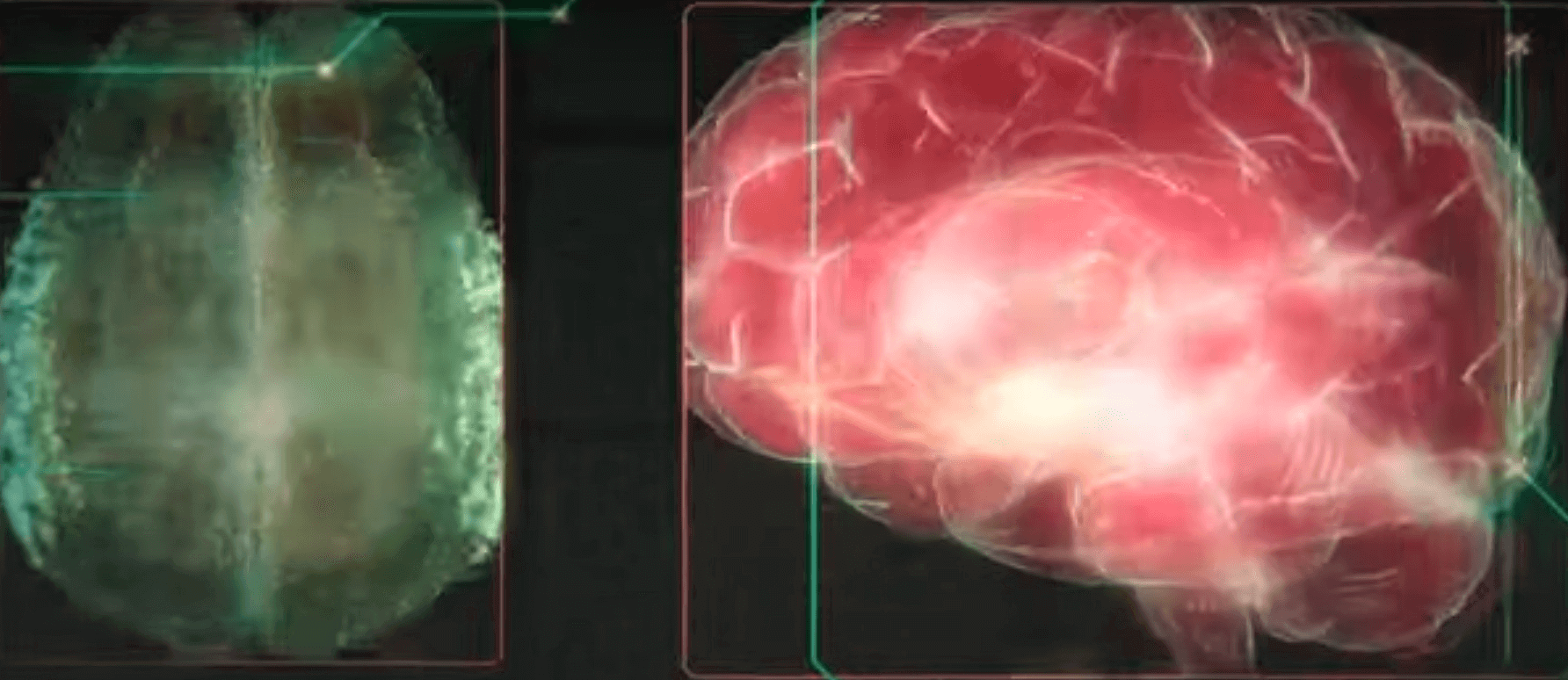 The Human Brain: A Marvelous Creation of God John 10:10 Project ...